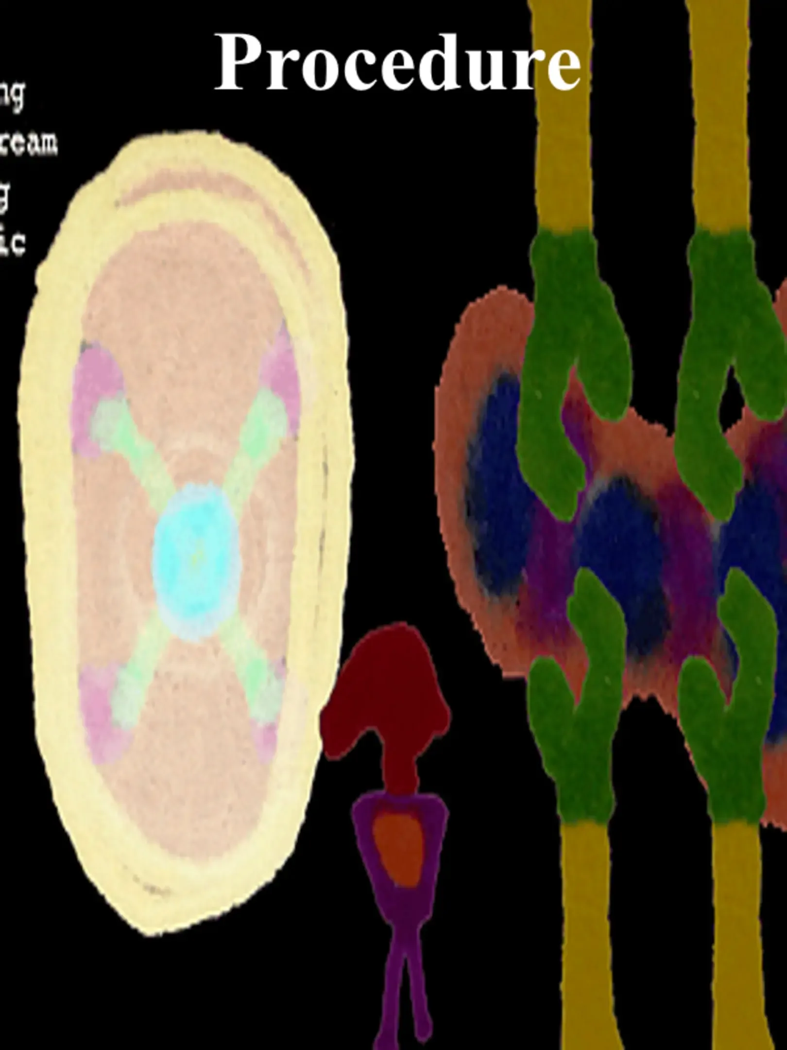 Procedure | Stash - Games tracker